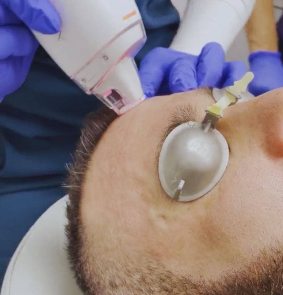 LaseMD Ultra Laser Thulium - Institut Oderma